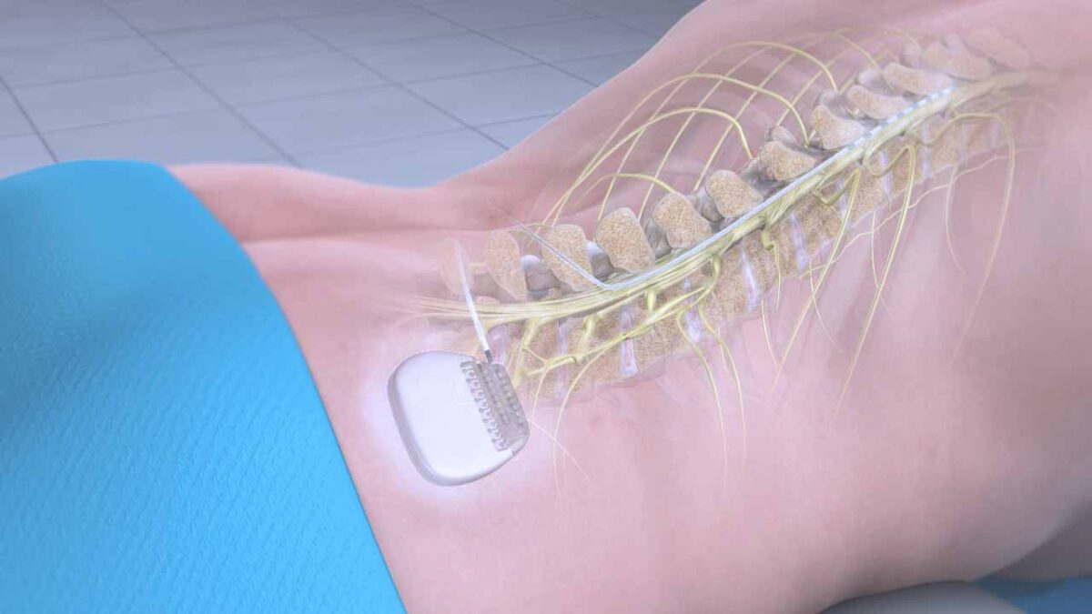 Epidural Port ve Morfin Pompası İmplantasyonu