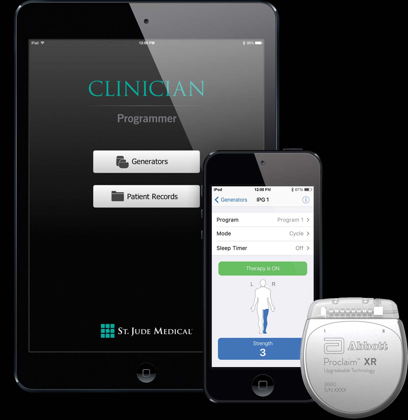 Spinal Cord Stimulation for Diabetic Peripheral Neuropathy